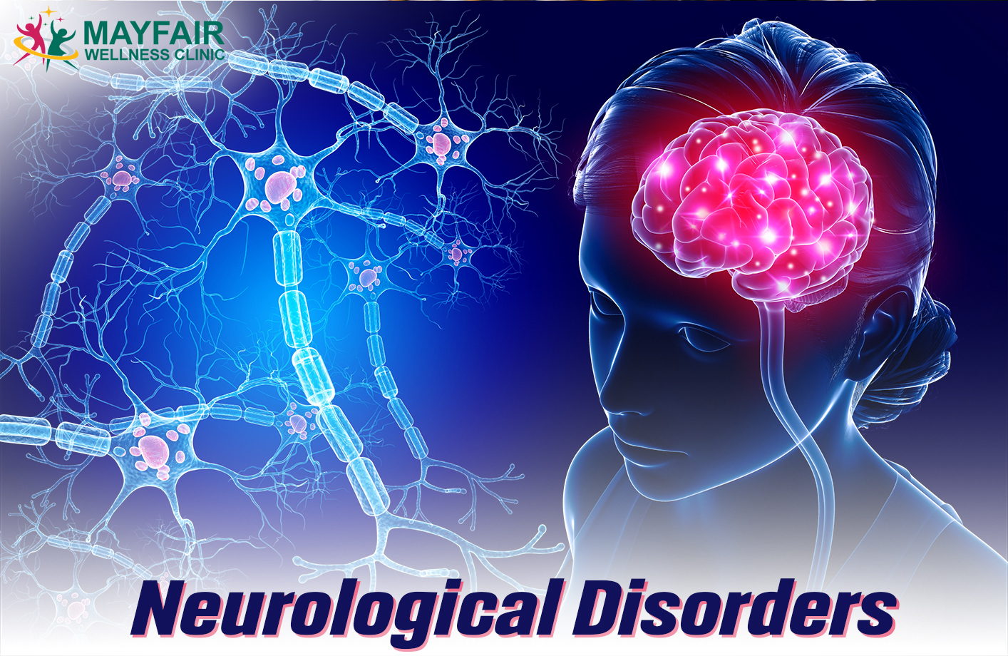 Neurological Disorders - Mayfair Wellness Clinic